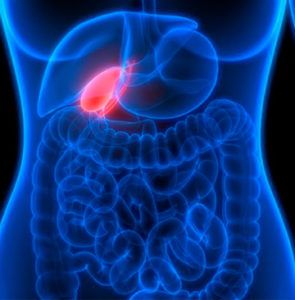 Pedra na Vesícula | Dr. Silvio Ikoma - Endoscopia Digestiva