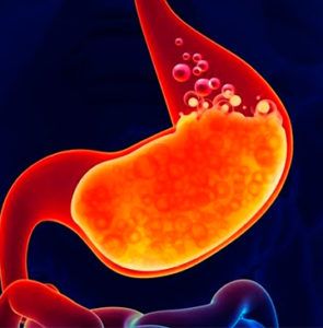 Refluxo Gastroesofágico | Dr. Silvio Ikoma - Endoscopia Digestiva